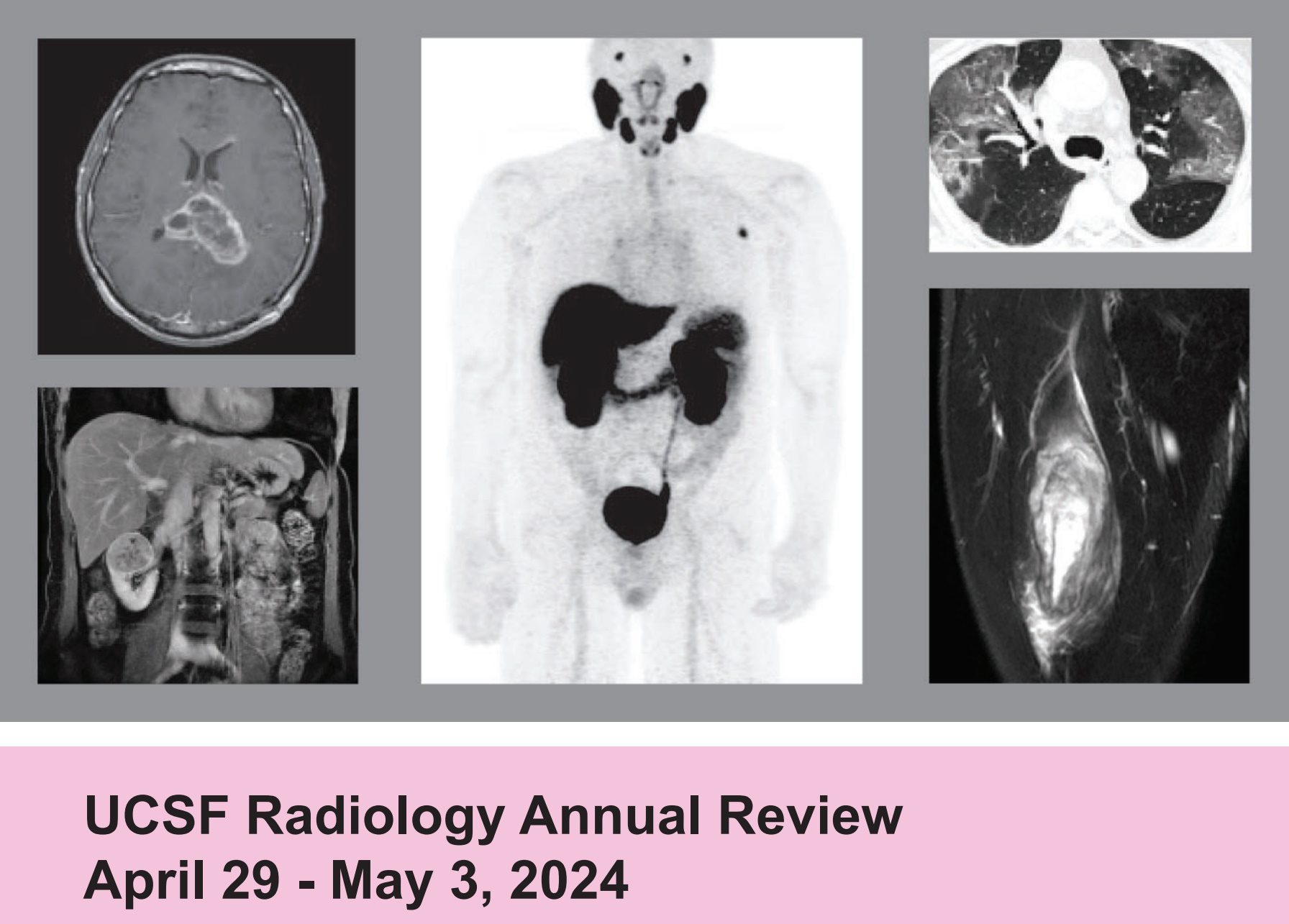 UCSF Radiology Annual Review – 2024 - Medical Education Videos